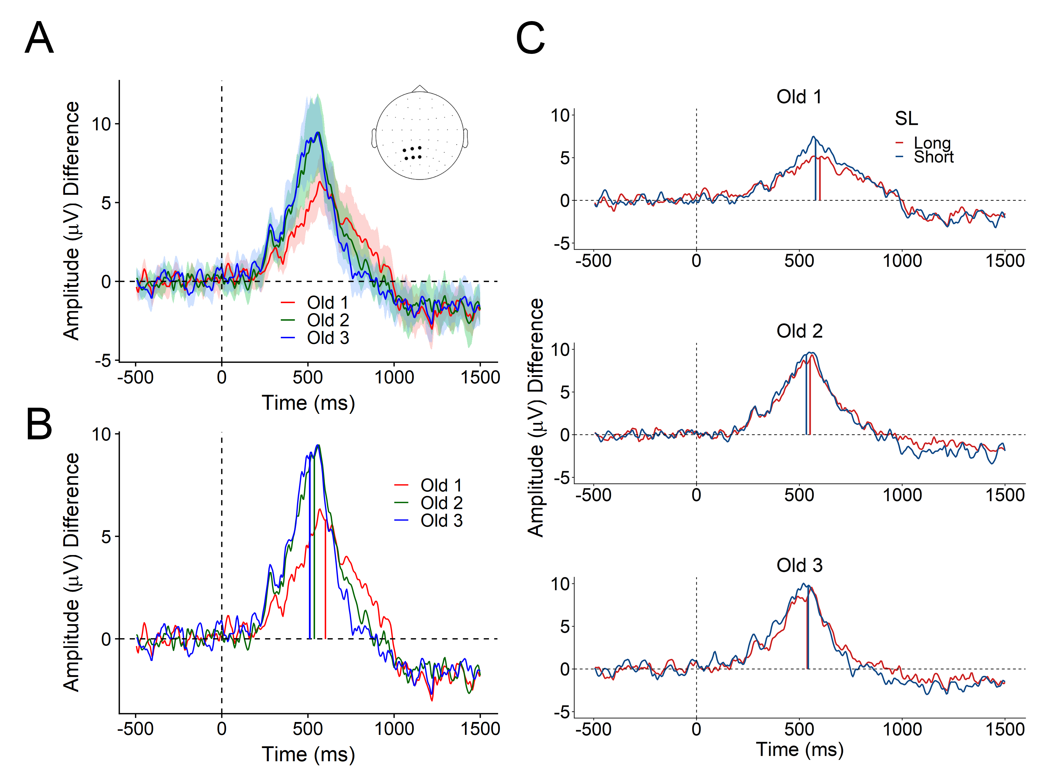 Repetition Attenuates the Influence of Recency on Recognition Memory ...